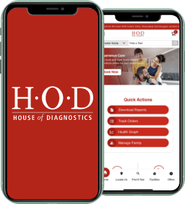 ESR - Erythrocyte Sedimentation Rate | HOD
