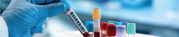 डीएलसी (DLC Test) और टीएलसी जाँच (TLC Test in Hindi)- WBC Count | HOD