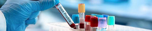 What is Iron Profile test? | HOD