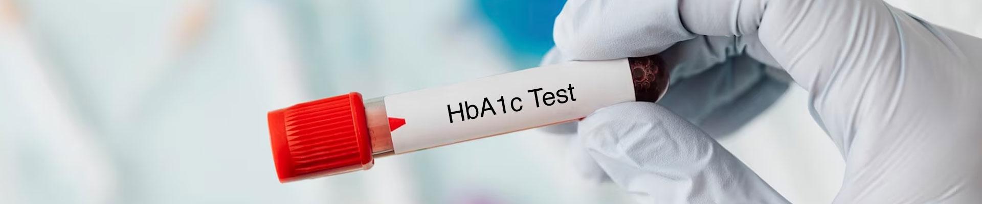 HbA1c Test: Definition, Purpose, and Significance | HOD