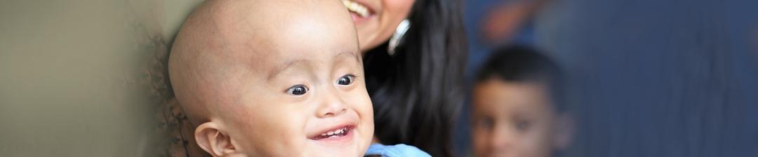 Hydrocephalus - Symptoms, Causes, Types And Complications | HOD