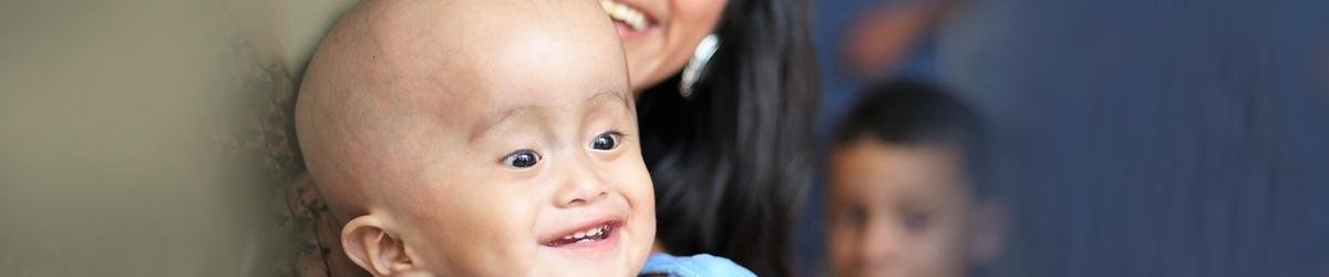 Hydrocephalus - Symptoms, Causes, Types And Complications | HOD