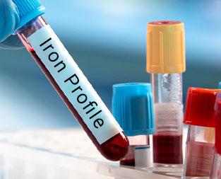 डीएलसी (DLC Test) और टीएलसी जाँच (TLC Test in Hindi)- WBC Count | HOD