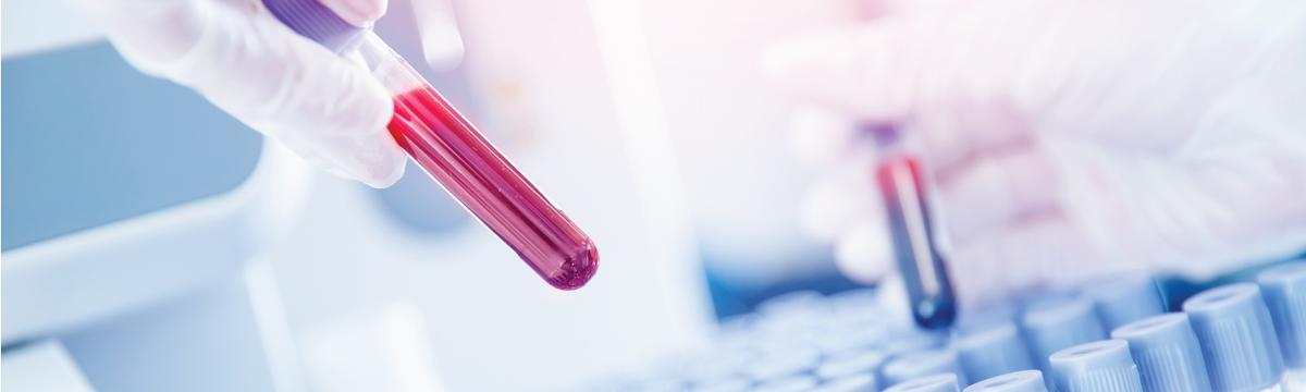 Blood Group Test in Delhi NCR | Price ₹149* | HOD