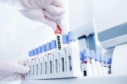 HOD Diagnostic Centre Facilities | Scan | Path Lab | HOD
